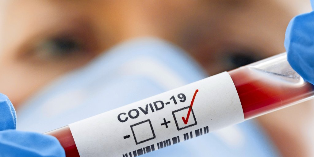 Corona-Inzidenz im Kreis Hildesheim erreicht neuen Herbst-Höchststand